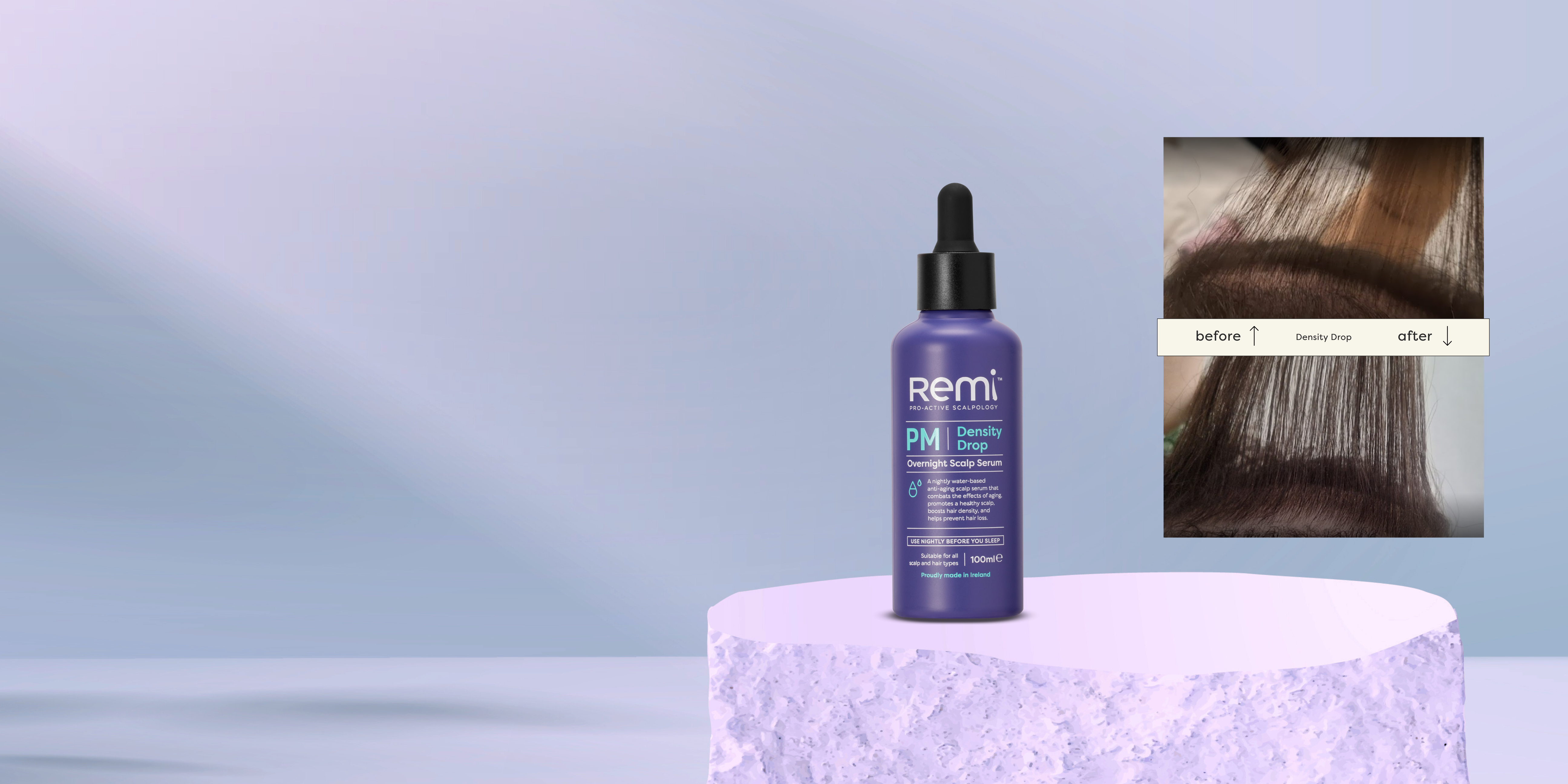 Remi - Scalp Care | Made In Ireland
